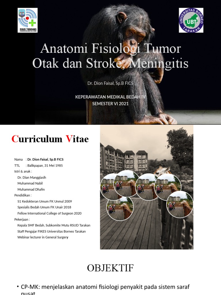 Anatomi Fisiologi Tumor Otak Dan Stroke, Meningitis | PDF