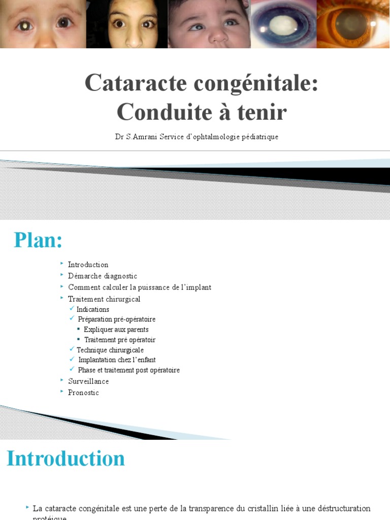 Cataracte congénitale CAT.pptx 1 | PDF | Échographie | Cataracte