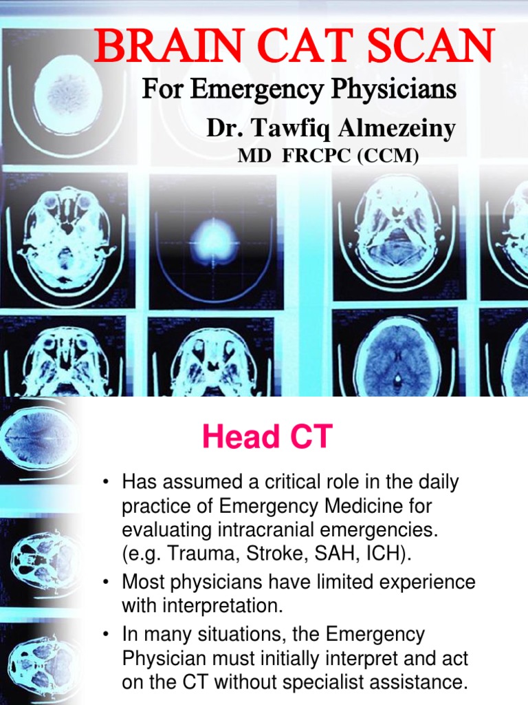 Brain CT Scan | PDF | Ct Scan | Cerebrospinal Fluid