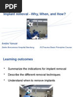 K-Wire & Fixator Removal Guidelines | PDF