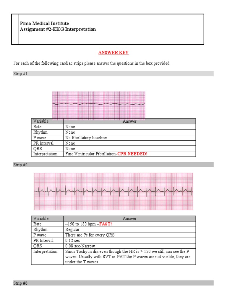 EKG - Assignment Without Answers | PDF | Cardiac Arrhythmia | Physiology