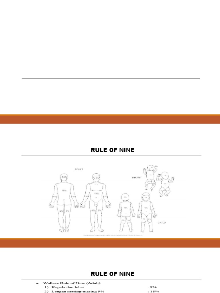 Understanding the Rule of Nine | PDF