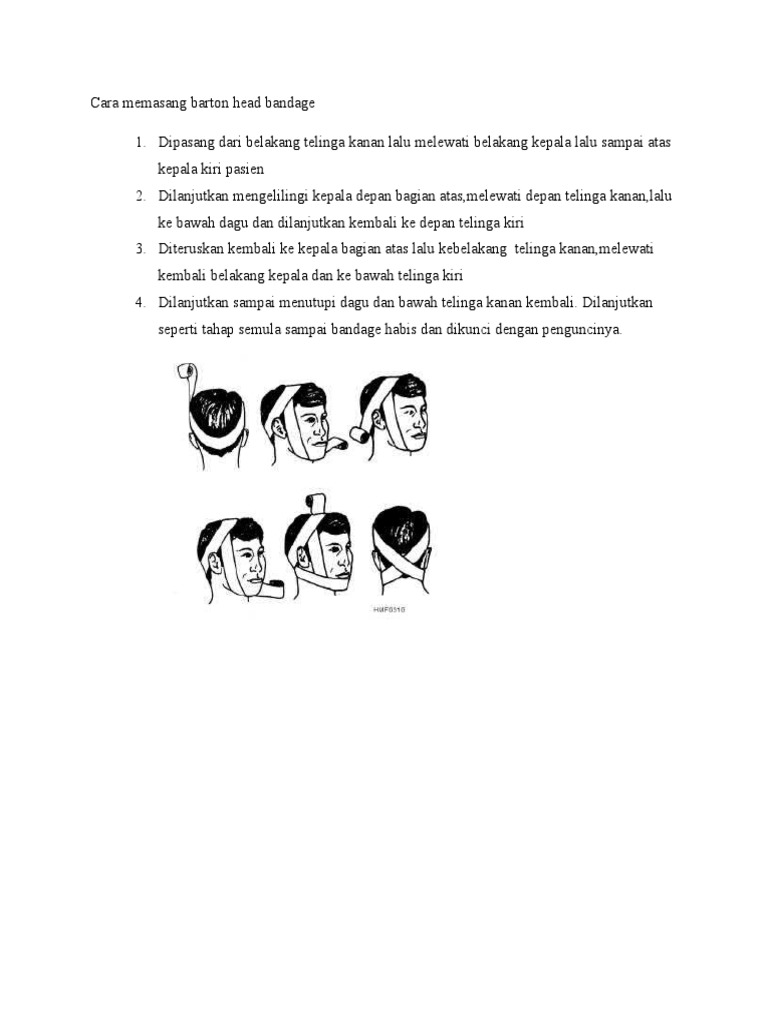 Cara Memasang Barton Head Bandage | PDF