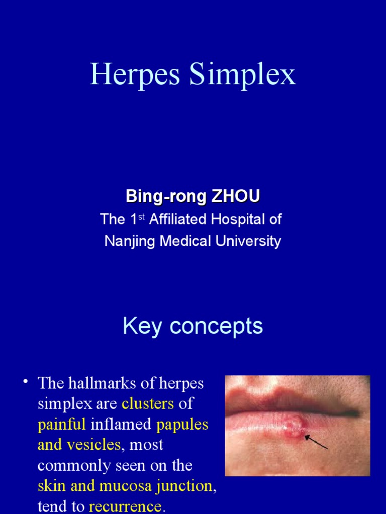 Herpes Simplex: Bing-Rong ZHOU | PDF | Herpes Simplex | Diseases And ...