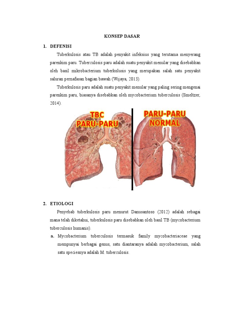 LP TB Paru Kasus Wajib | PDF