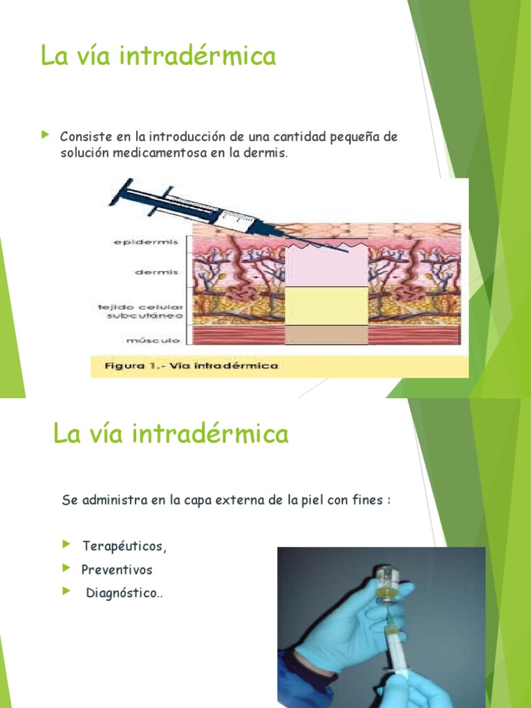 Clase 9 Via - Intradermica | PDF | Medicamentos con receta | Mano