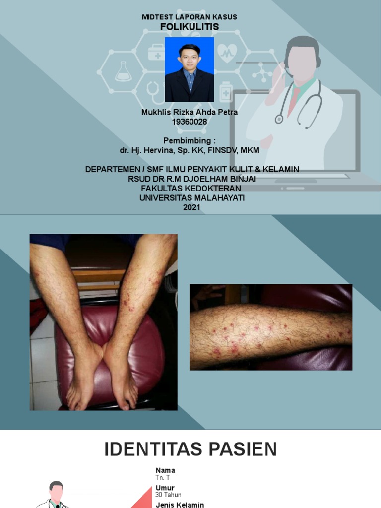 LAPKAS-Folikulitis | PDF