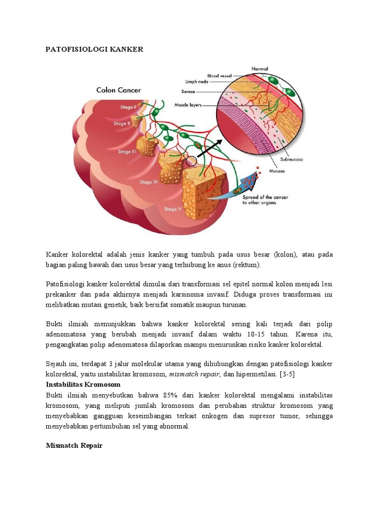 Patofisiologi Kanker | PDF