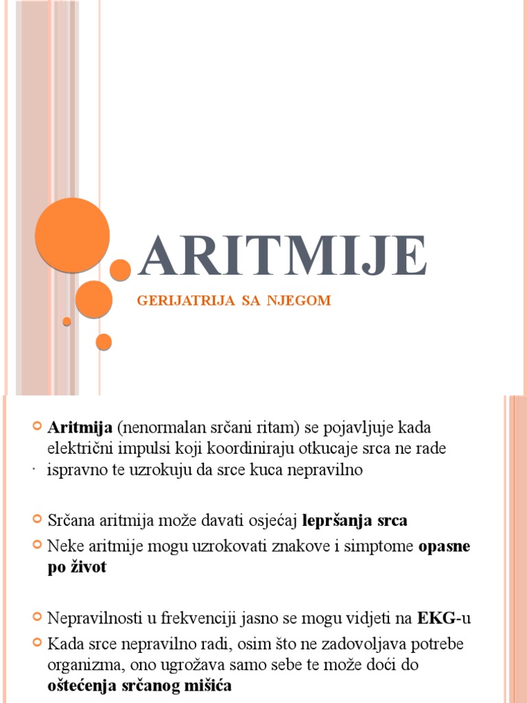 Aritmije | PDF