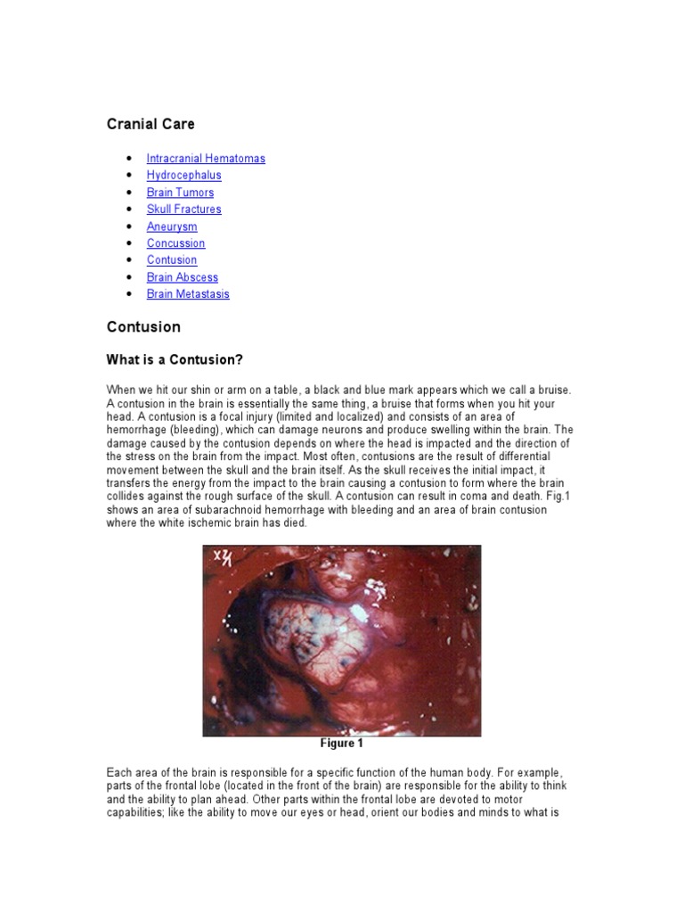 Cranial Care: What Is A Contusion? | PDF | Brain | Traumatology