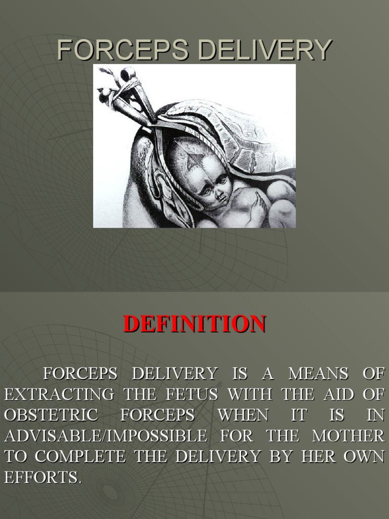 Forceps Delivery | PDF | Maternal Health | Childbirth