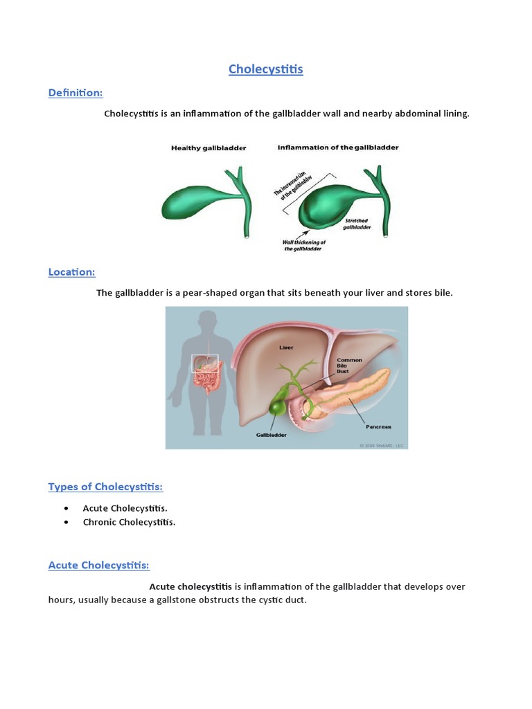 Cholecystitis: Types and Nursing Care Plan | PDF