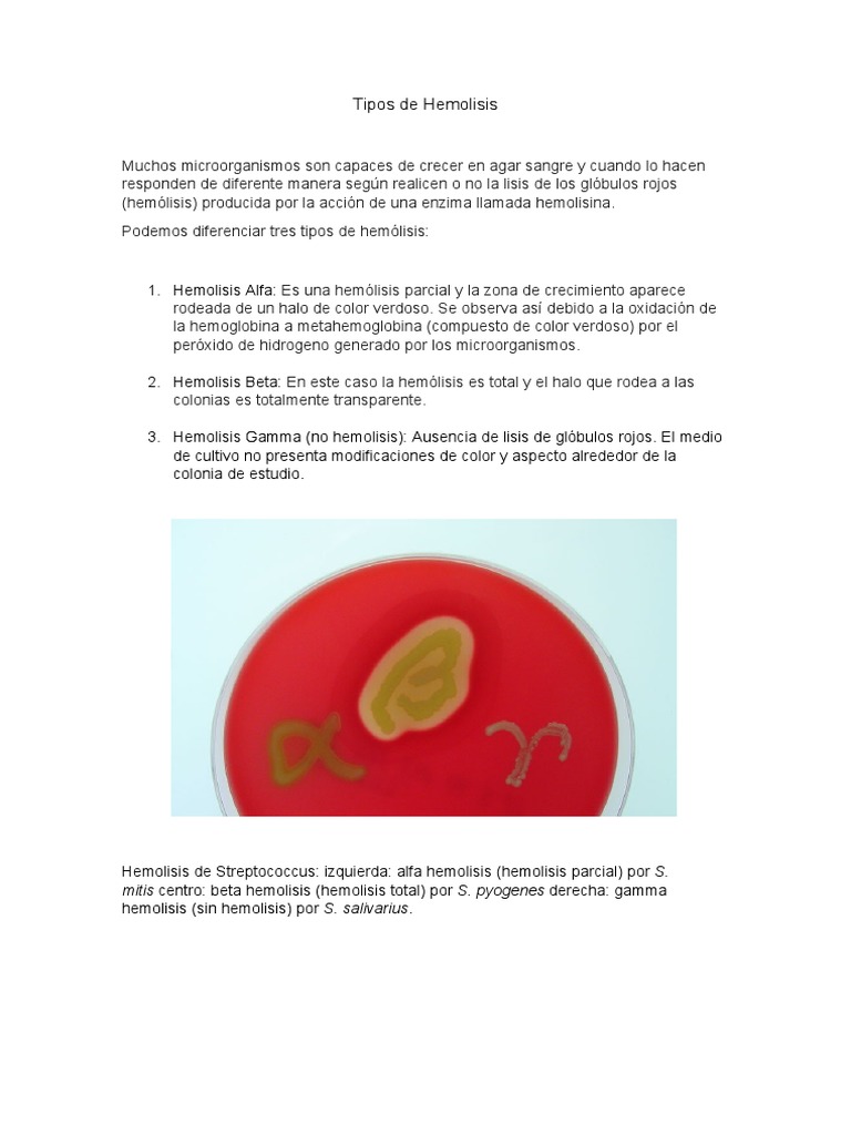 Tipos de Hemolisis | PDF