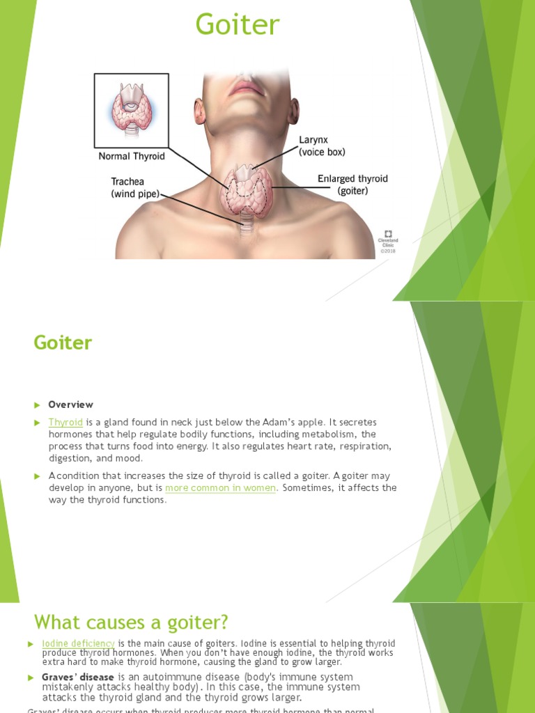 Endemic and Sporadic Goiter | PDF | Thyroid | Hyperthyroidism