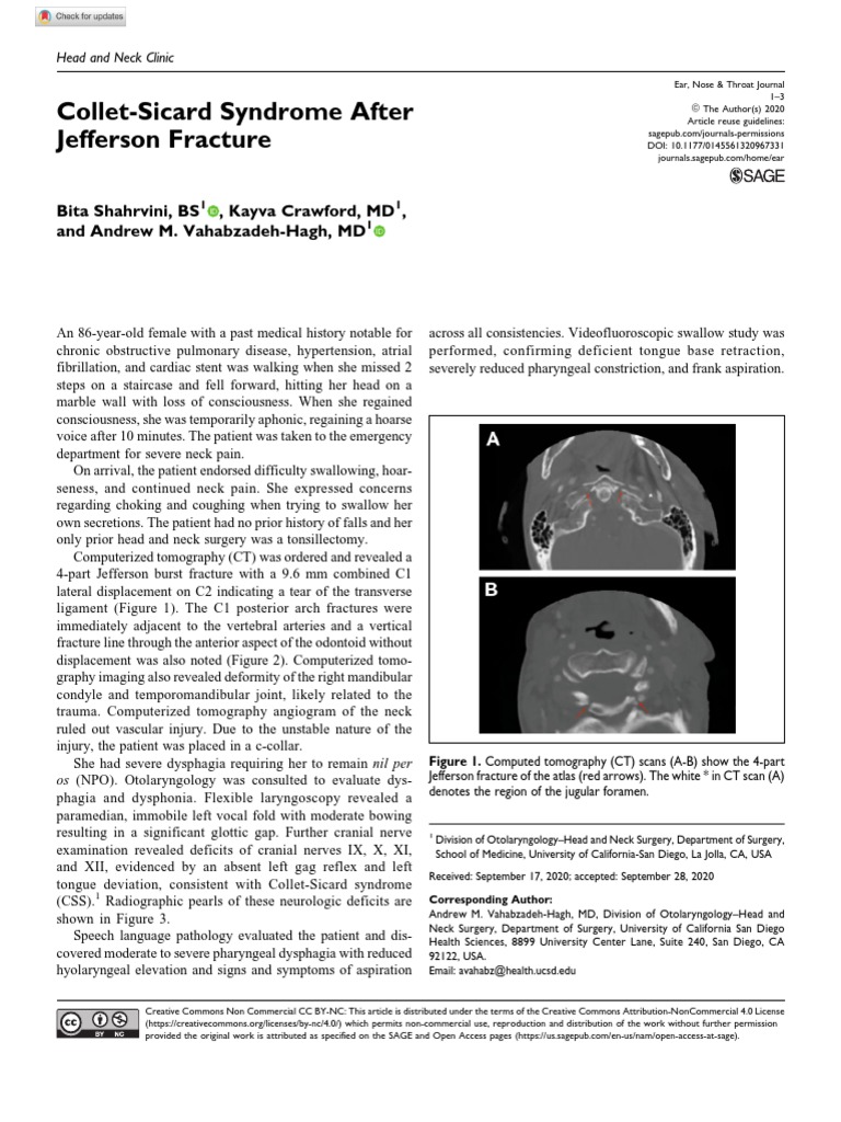 2020 Collet-Sicard Syndrome After Jefferson Fracture | Download Free ...