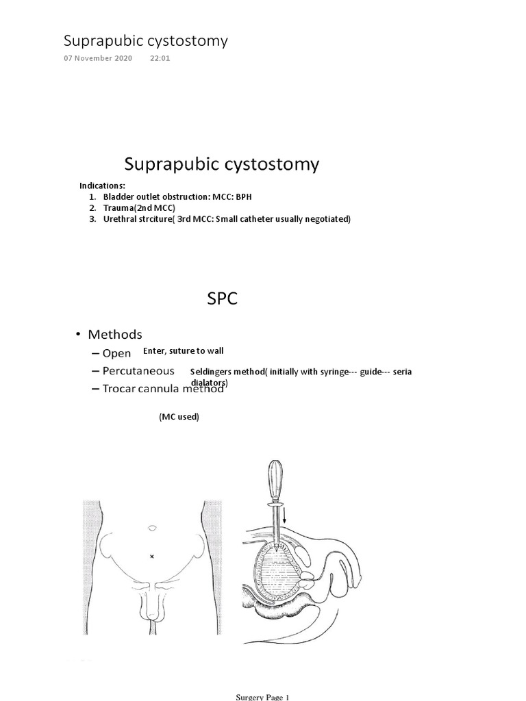Suprapubic Cystostomy | PDF