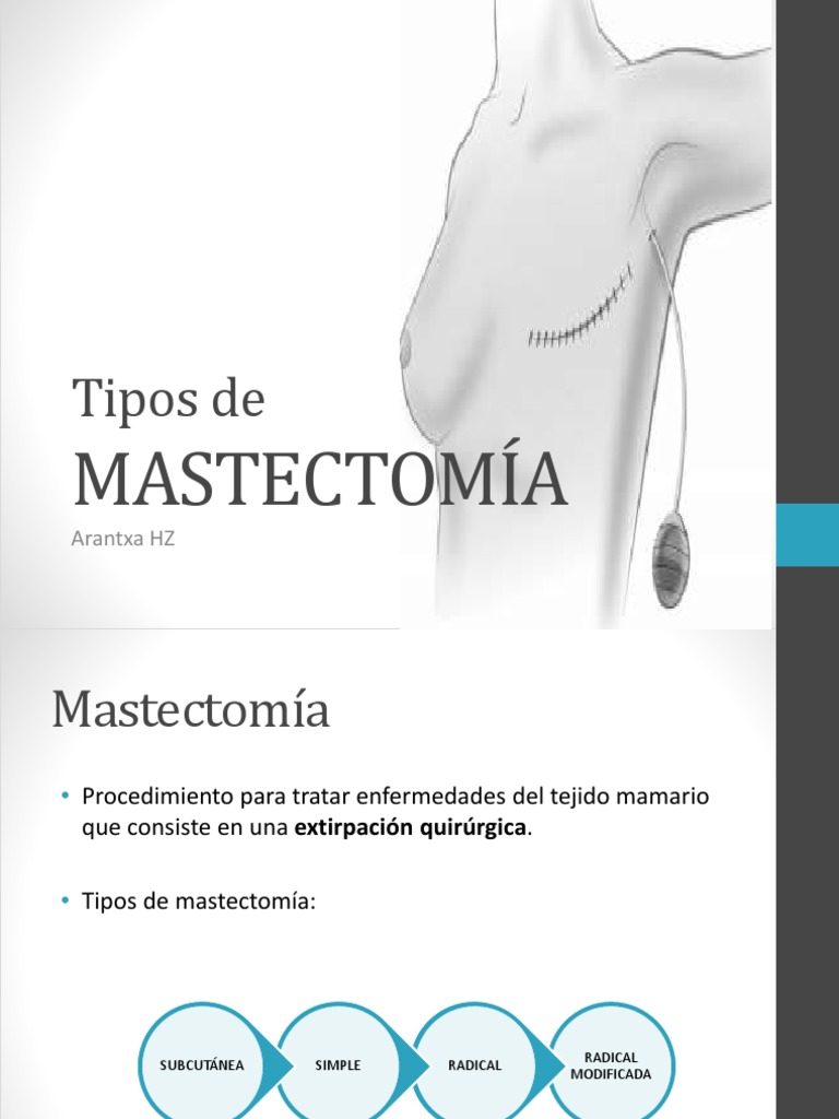 Tiposdemastectomafinal 150409094642 Conversion Gate01 | PDF | Pecho ...