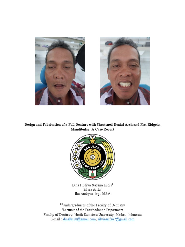 Design and Fabrication of A Full Denture With Shorthened Dental Arch ...