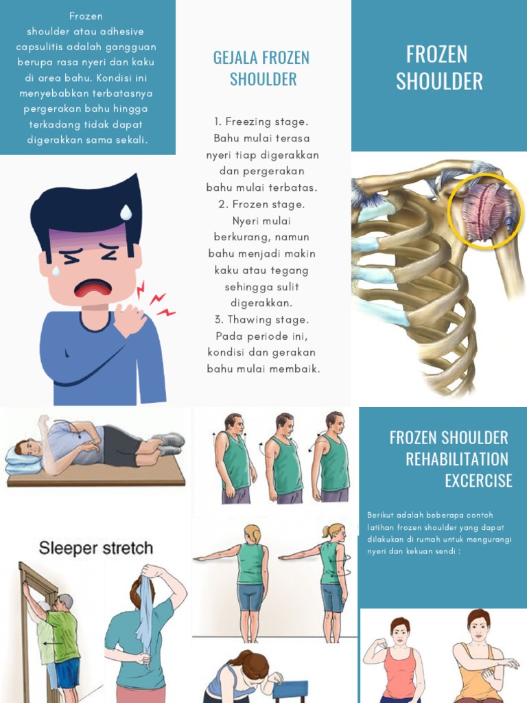 Gejala dan Latihan Frozen Shoulder | PDF
