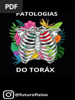 Tórax Tonel, Pectus Carinatum e Pectus Exacavatum | PDF | Doença de ...