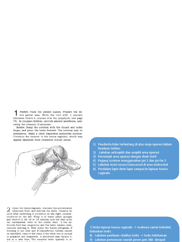 Operasi Torsio Testis - Perumperindo.co.id