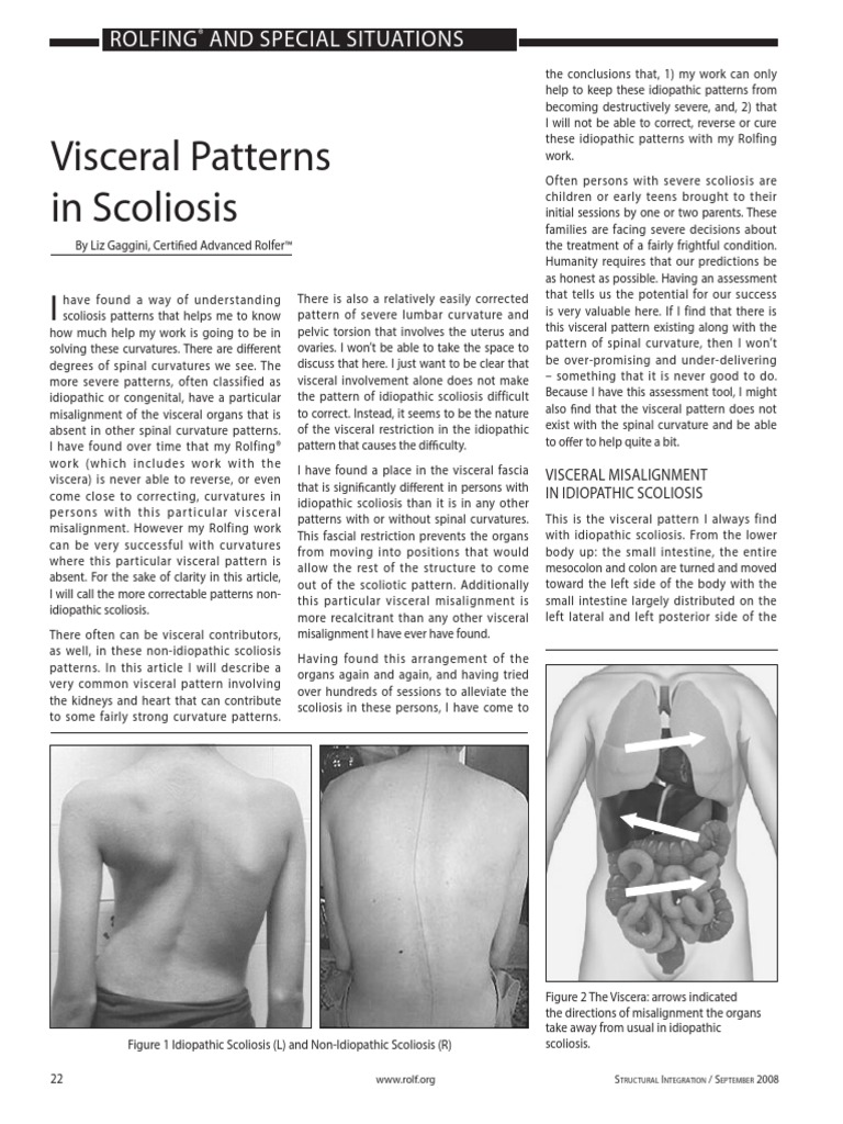 Visceral Patterns in Scoli | PDF | Scoliosis | Kidney