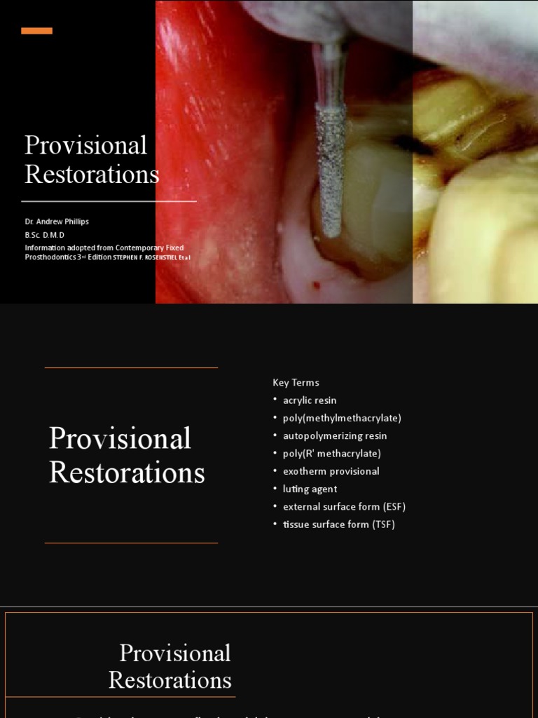Provisional Restorations | Download Free PDF | Dentures | Periodontology