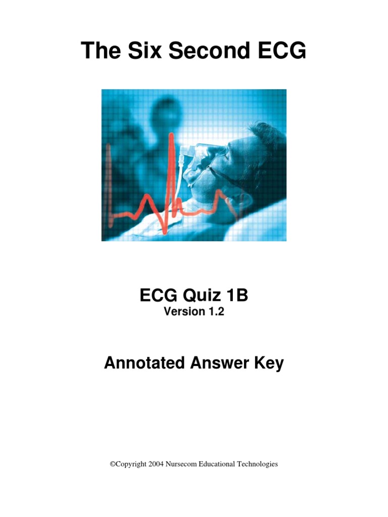 The Six Second ECG | PDF | Electrocardiography | Cardiovascular Physiology