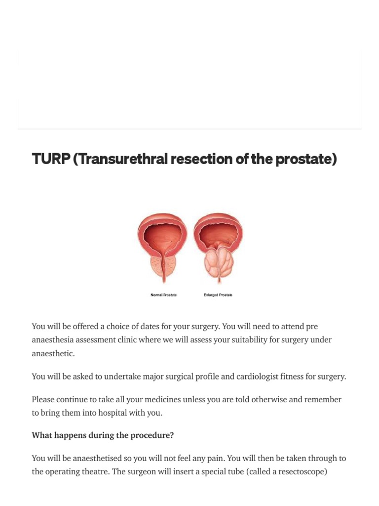 TURP (Transurethral Resection of The Prostate) | PDF