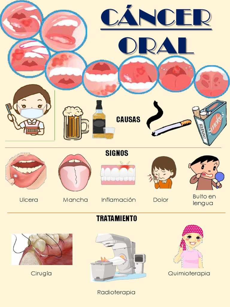 Infografia Cancer Oral | PDF