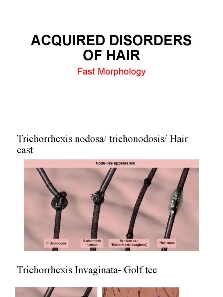 Acquired Disorders of Hair Saad | PDF