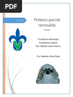 Principios PPR Apoyos, Retenedor Directo e Indirecto | PDF | Dentadura ...