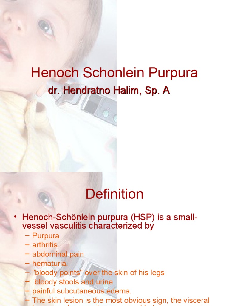 Henoch Schonlein Purpura: Dr. Hendratno Halim, Sp. A | PDF | Diseases ...