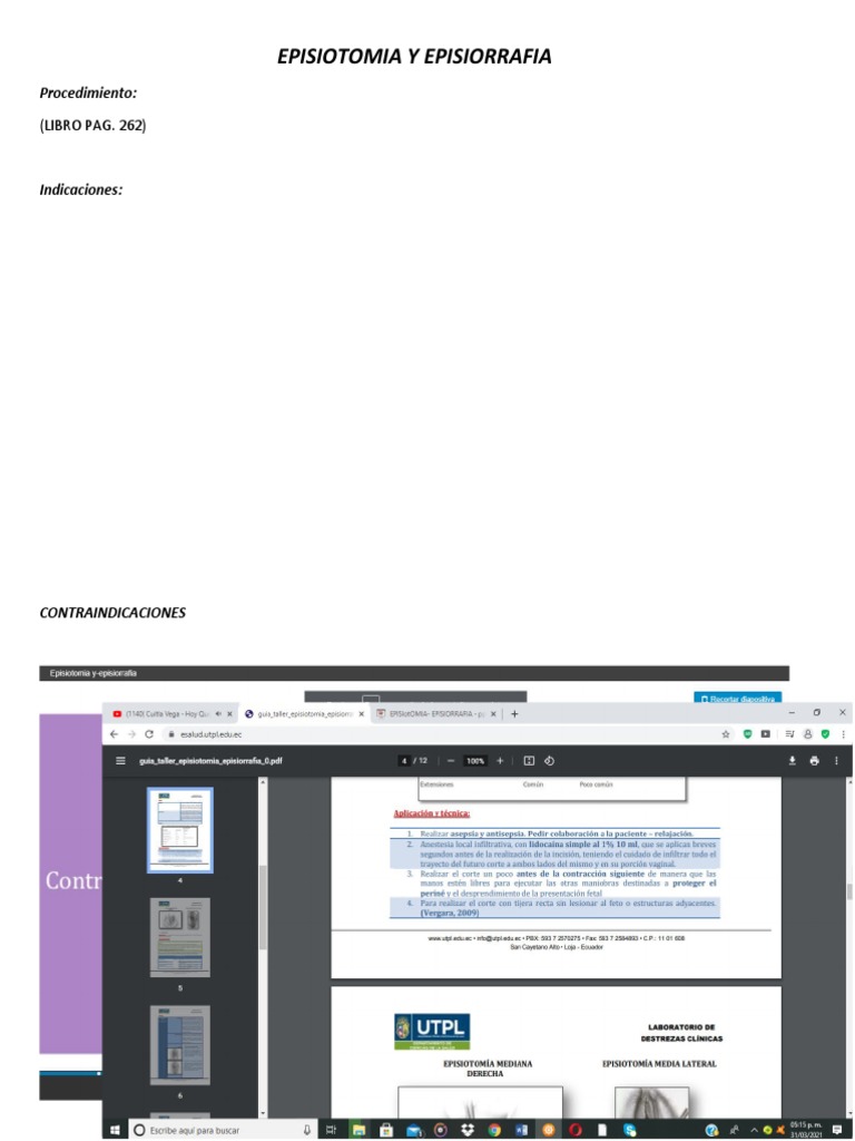 Episiotomia y Episiorrafia | PDF