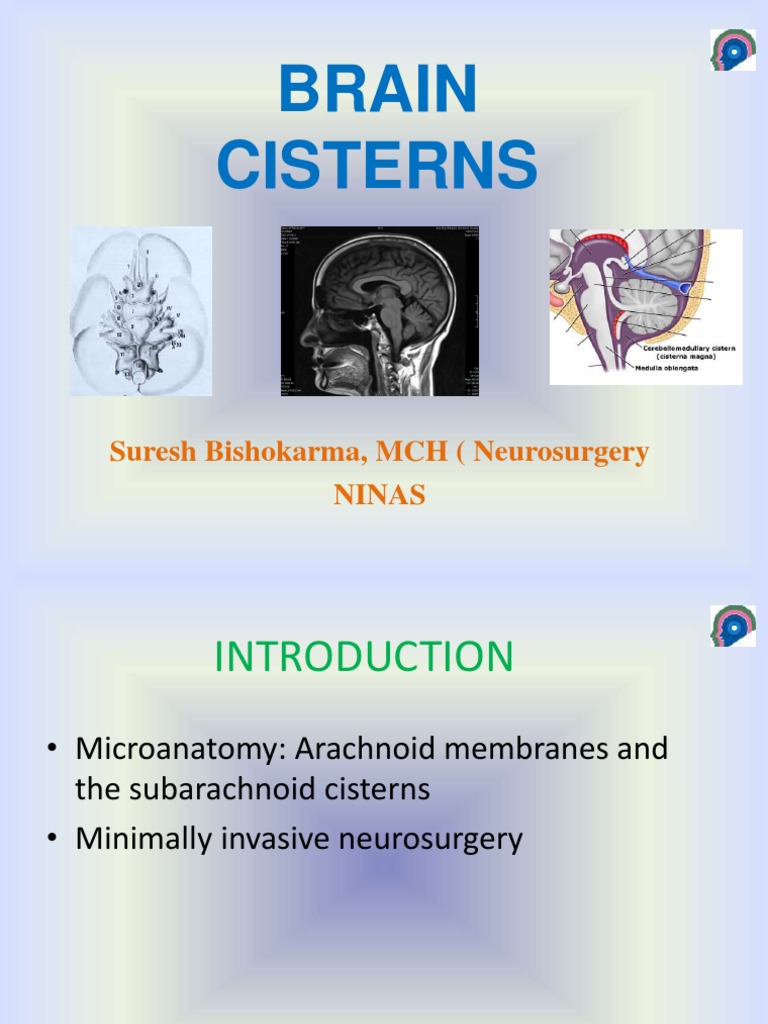 Suprasellar Cistern Anatomy Brain Cisterns: Suresh Bishokarma, MCH