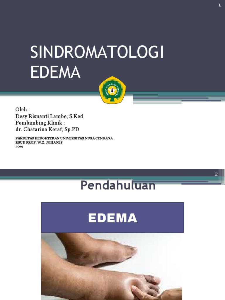 Edema: Panduan Medis Lengkap | PDF