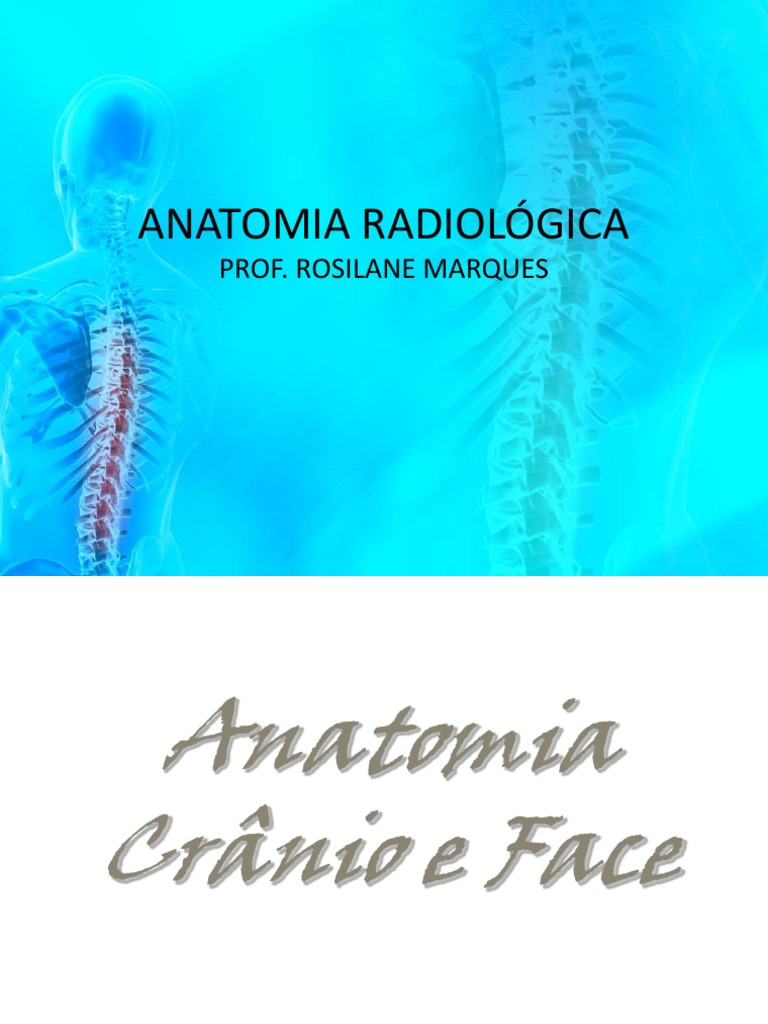 Anatomia Radiológica do Crânio: Ossos, Suturas e Fontículos | PDF ...