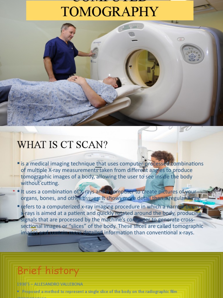 Computed Tomography | PDF | Tomography | Ct Scan