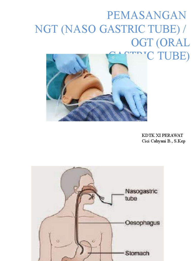 Panduan Pemasangan NGT dan OGT | PDF | Sains & Matematika