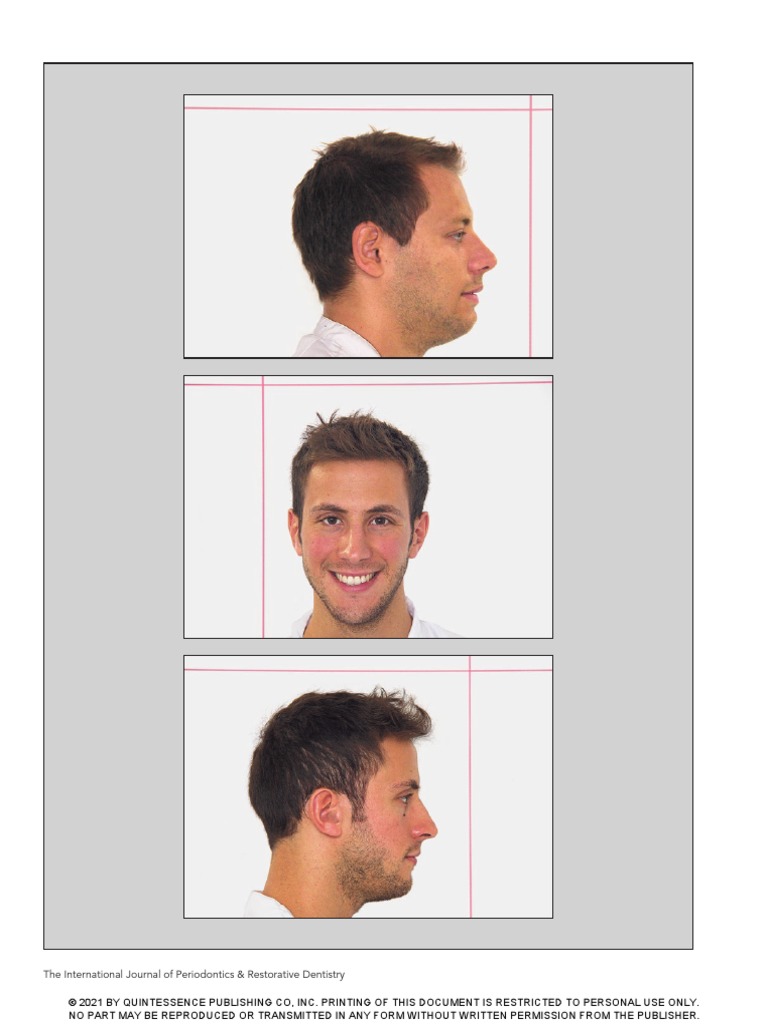 Determination of Facial References For Esthetic Restorative Treatment ...