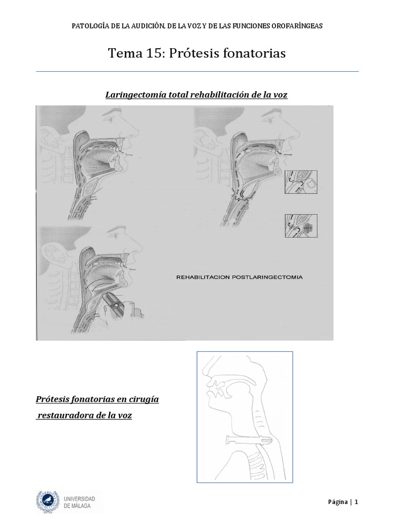 TEMA 15. Prótesis Fonatorias | PDF | Especialidades Medicas | Medicina