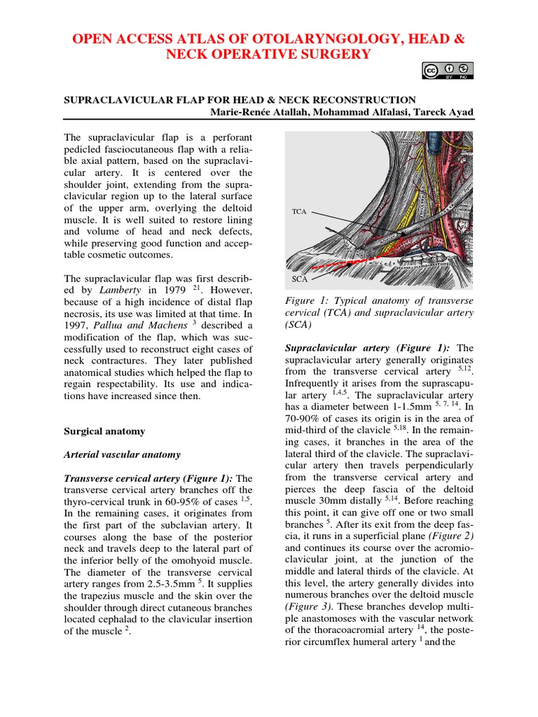 Supraclavicular Flap For Head - Neck Reconstruction | PDF ...