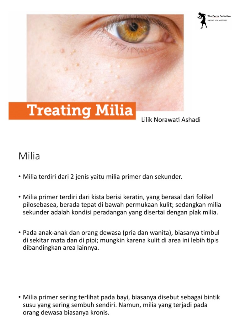 Treating Milia | PDF