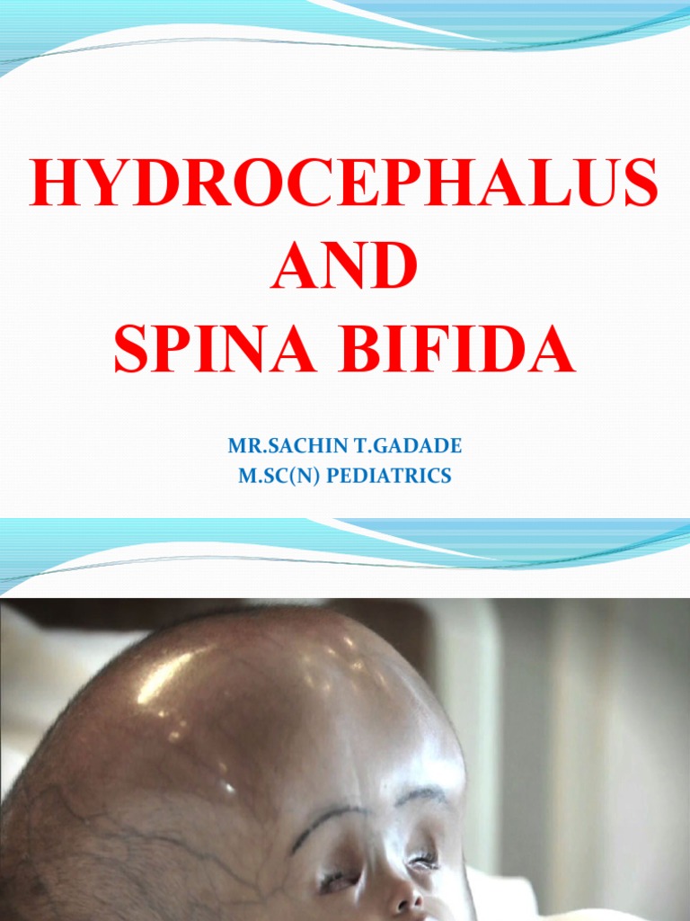 Hydrocephalus AND Spina Bifida: MR - Sachin T.Gadade M.SC (N ...