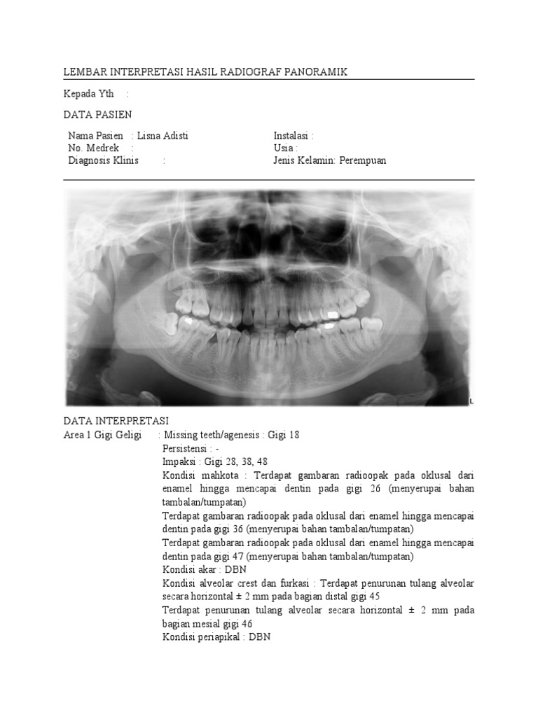 Panoramik Gina Aulia Suwandi - Pasien Lisna Adisti | PDF