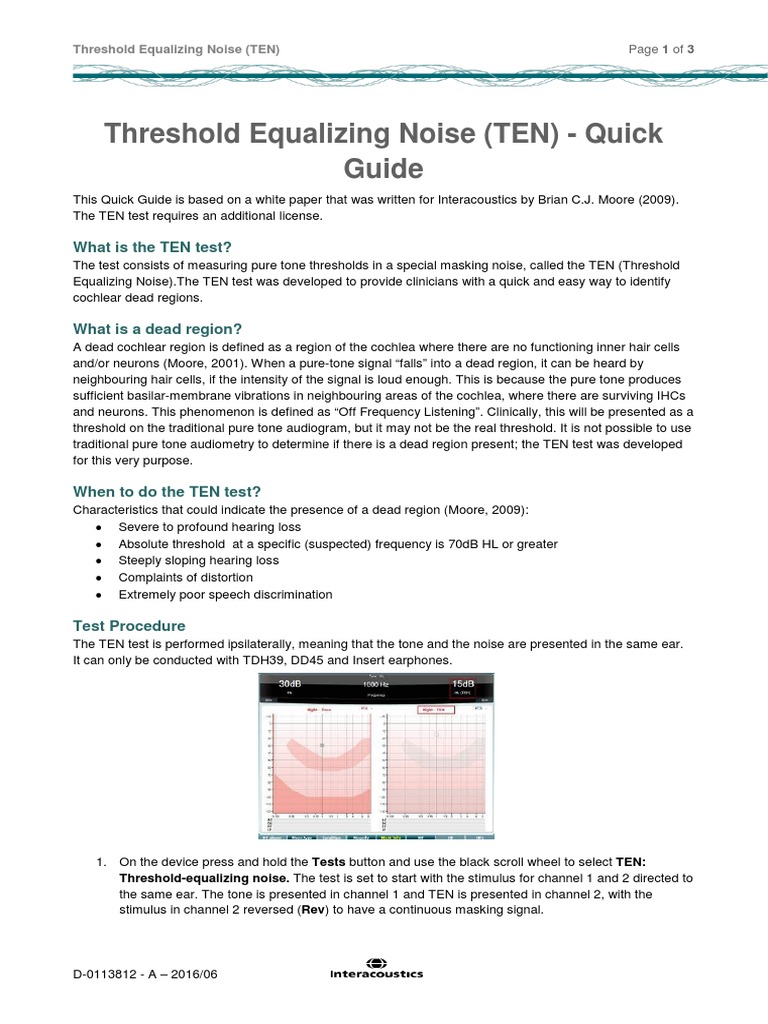 Threshold Equalizing Noise (TEN) - Quick Guide: What Is The TEN Test ...