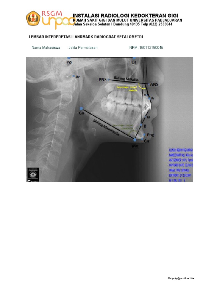 2 - Interpretasi Landmark Sefalometri - Aliya (Jelita P. 160112180045 ...