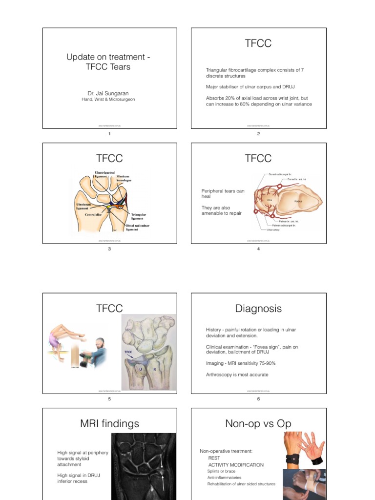 Update On Treatment TFCC Tears DR Jai Sungaran | PDF | Musculoskeletal ...