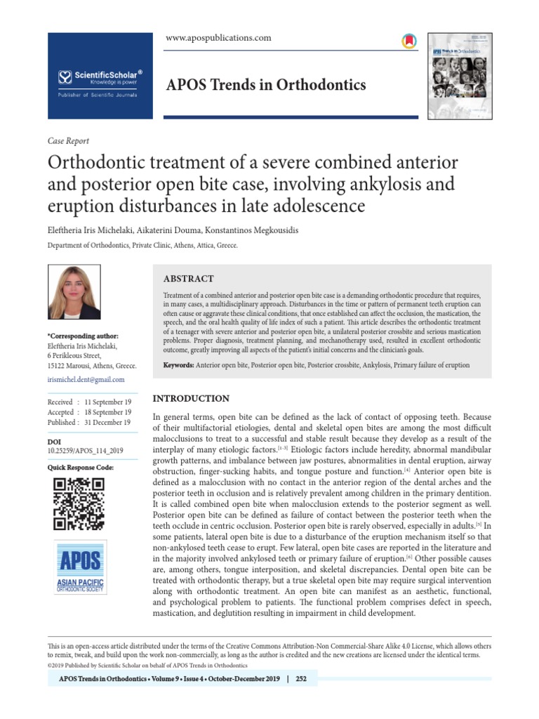 Orthodontic Treatment of A Severe Combined Anterior and Posterior Open ...