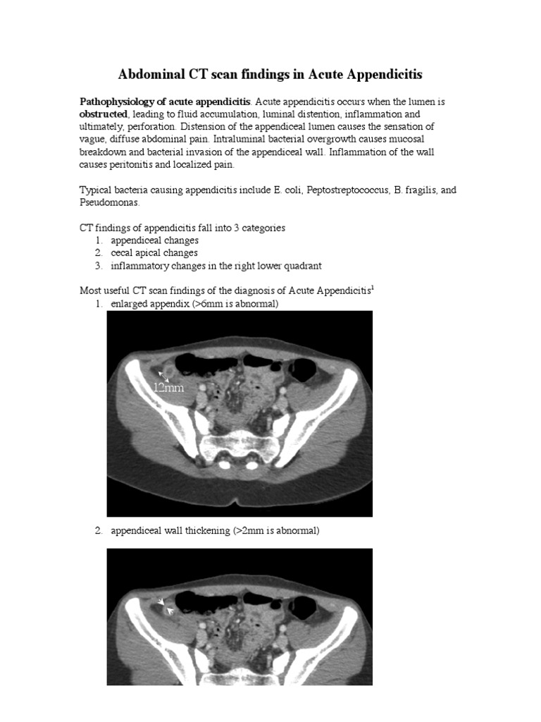 CT Findings in Appendicitis | PDF | Clinical Medicine | Medical Specialties